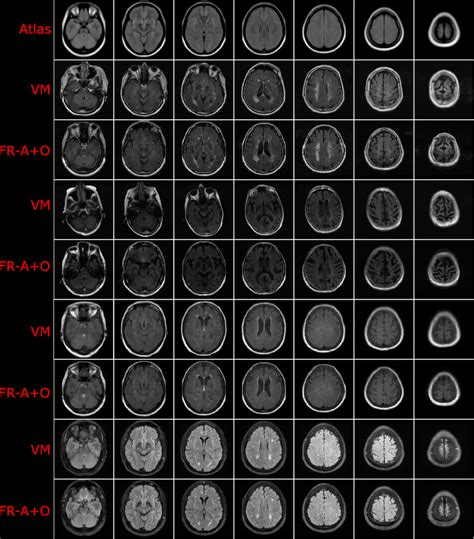 visual comparison between voxelmorph and flowreg a o the top row