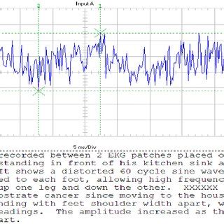 An Oscilloscope Waveform Showing The 60 Hz Blue Sine Wave Channel 1 Download Scientific