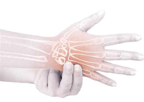 Is My Hand Broken Quiz Quiznow