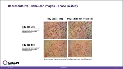Follicum Fol005 Trichoscan Follicle Thought