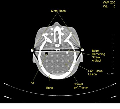 Figure 1 From Suppression Of The Ct Beam Hardening Streak Artifact Using Predictive Correction