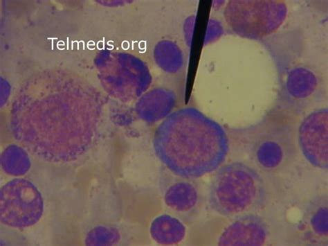 Eritroblasto BasÓfilo Tamaño 10 15 µm Célula Redonda Con Núcleo Al