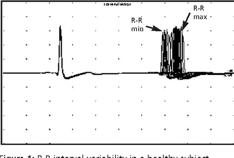 Figure 1 From R R Interval Variability Analysis With Electromyography Detects Early Autonomic