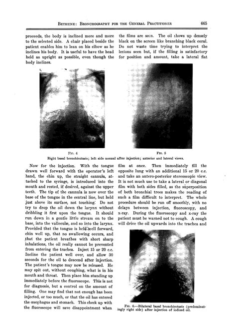 The Technique Of Bronchography For The General Practitioner Pmc