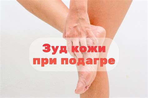 Зуд при подагре: почему чешется кожа при подагре