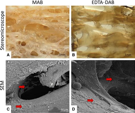 Macro—and Microscopic Analysis Of The Architecture Of Both The Mab And
