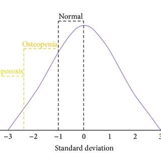 Standard Distribution Of T Score Based On DEXA Standard Outcomes Download Scientific Diagram