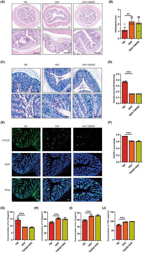 Cd36 Deficiency Aggravated Tbi‐induced Intestinal Inflammation And