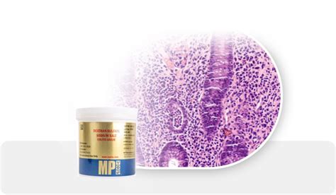 Lsm™ Lymphocyte Separation Medium Sterile Mp Bio