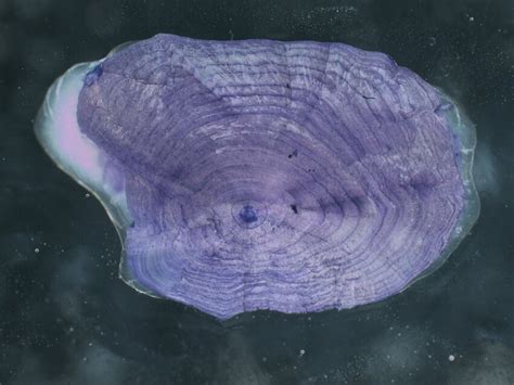 A European Eel Otolith Which Has Been Prepared For Age Analysis Once Download Scientific