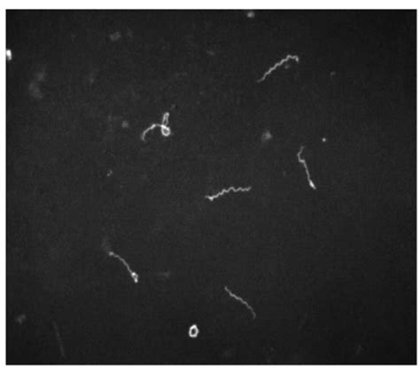 Sti Ii Vagt Sti Pid Flashcards Quizlet