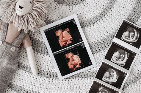 Genetikai Ultrahang Időpontok Medical Center Hatvan