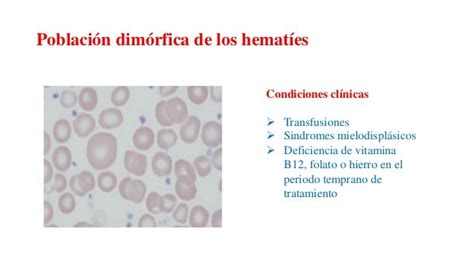 Alteraciones Eritrocitarias