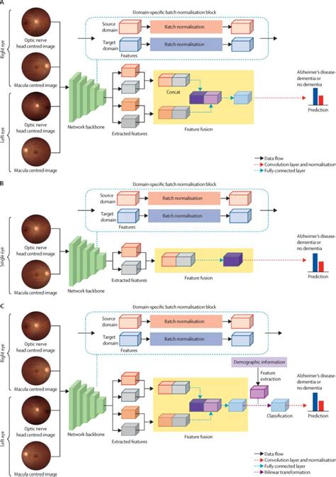 A Deep Learning Model For Detection Of Alzheimers Disease Based On