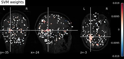 Nilearn Statistical Analysis For Neuroimaging In Python — Machine