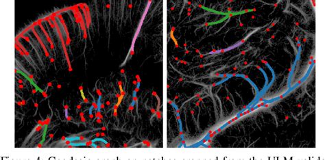 Fitting Tree Model With Cnn And Geodesics To Track Vesselsand
