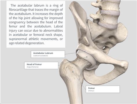 Acetabular Labrum Tear — Physiou