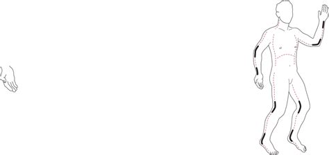 ImageМісця розрізів при есхаротомії Msd Manual Professional Edition