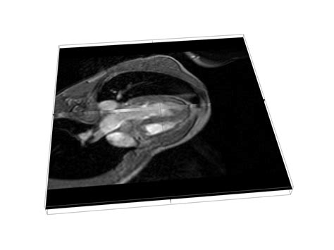 DICOM Example Chapter DICOM Images ArtiSynth Modeling Guide
