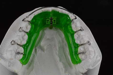 Kfo Cs Zahntechnik In Landsberg Am Lech