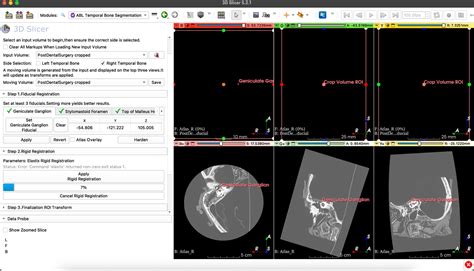 Elastix Returned Non Zero Exit Status 1 Support 3d Slicer Community