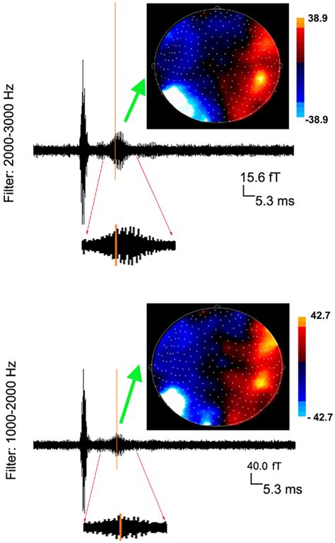 Averaged Waveforms And Contour Maps From One Subject Showing
