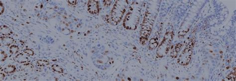 Immunohistochemistry Ihc Wax It Histology Services Inc