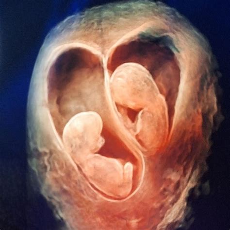 ЈЗУ Универзитетска Клиника за Гинекологија и Акушерство Скопје Added A ЈЗУ Универзитетска