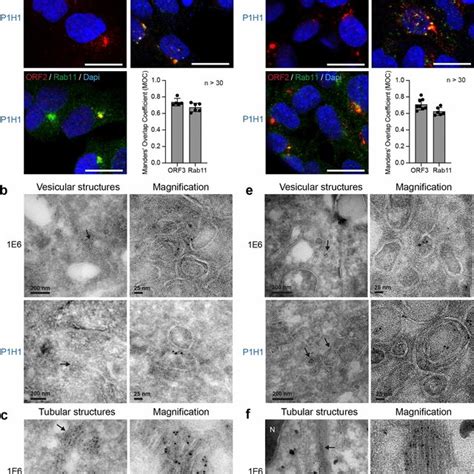 Identification Of Hev Induced Vesicular And Tubular Structures In