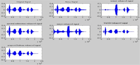 shows the time domain representation of noise free noisy and enhanced