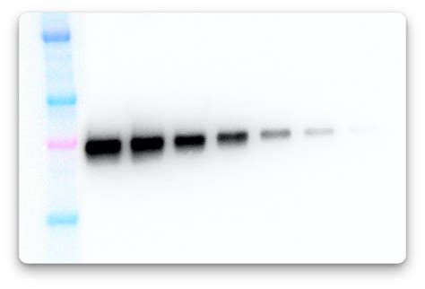 Azure 600 Ultimate Western Blot Imager Azure Biosystems