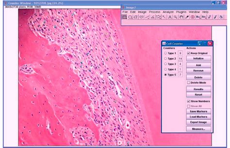 Inflammatory Cells Count Through Imagej Software Version Download