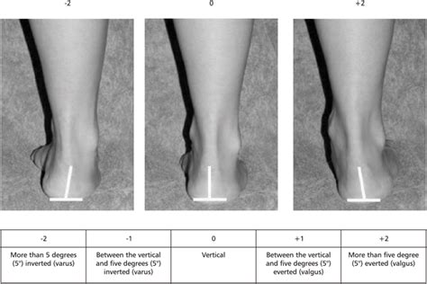 the evaluation of the inversion eversion of the calcaneus download