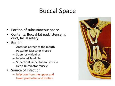 Buccal Space