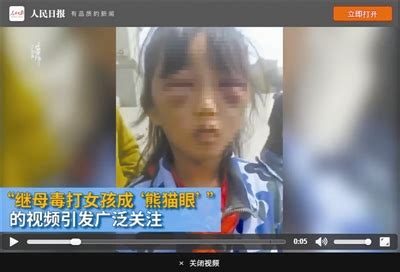 女孩被继母打成熊猫眼 新闻中心 温州网