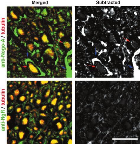 Cellular Localization Of Nogo A And Ngr Transverse Sections Of The