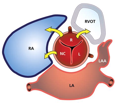 Sinus Of Valsalva Location