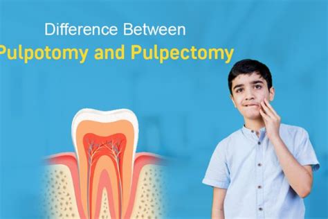 Pulpotomy Vs Pulpectomy Key Differences Explained
