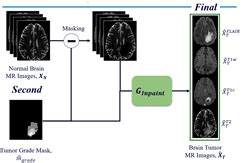 GitHub KSH BrainTumor