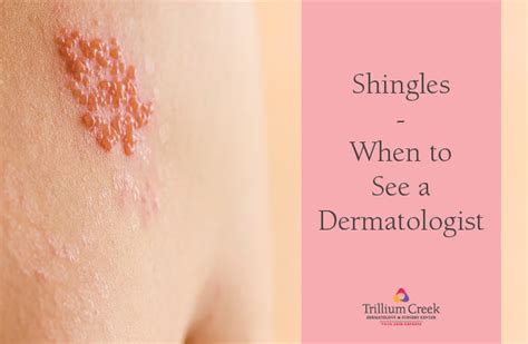 Shingles When To See A Dermatologist Trillium Creek Dermatology