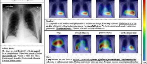 Figure 2 From Automatic Radiology Reports Generation Via Memory Alignment Network Semantic Scholar