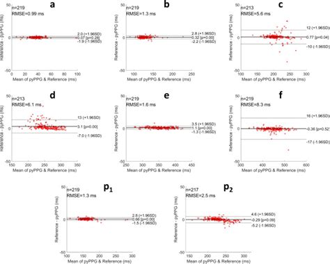 Pyppg A Python Toolbox For Comprehensive Photoplethysmography Signal
