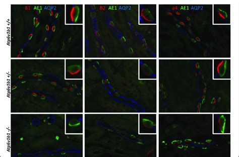 Subcellular Localization Of H Atpases In Type A Intercalated Cells Is Download Scientific