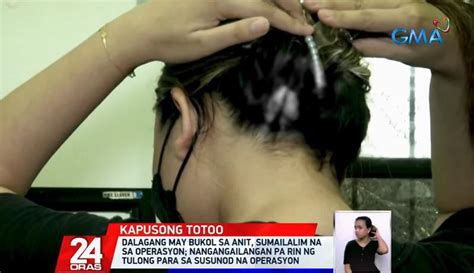 Woman With Lump On Scalp Undergoes Surgery Through Gma Kapuso