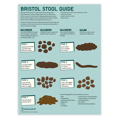 Bristol Stool Chart Poster Bristol Stool Chart Images Browse 99