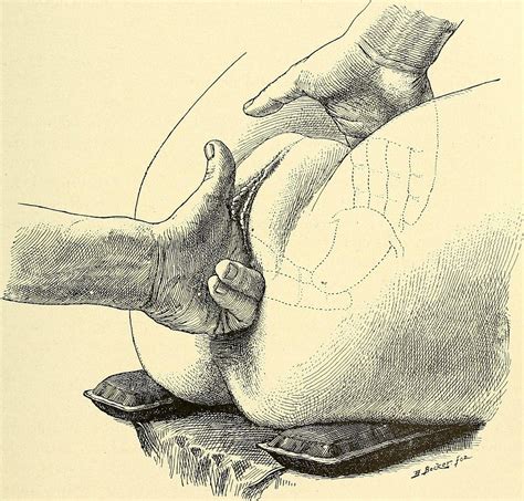 Sex In Slit Drawings Porn