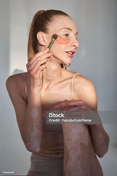 마사지 롤러와 눈 밑에 패치를 적용 하는 Vitiligo 피부를 가진 소녀 25 29세에 대한 스톡 사진 및 기타 이미지 25 29세 건강관리와 의술 건강한 생활방식