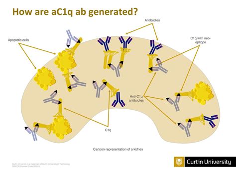 anti c1q antibodies concentrations by elisa in systemic lupus