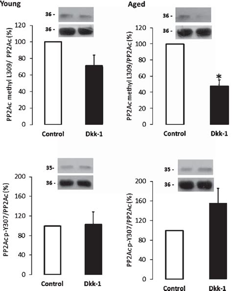 Effect Of Dkk 1 On Pp2a Phosphorylation And Methylation At Different