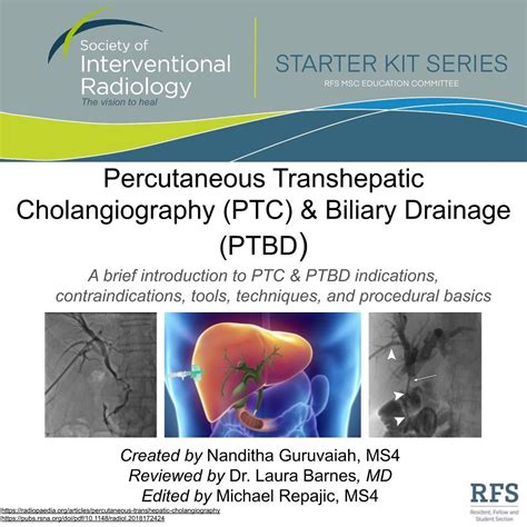 Percutaneous Transhepatic Cholangiogram Uses Side 54 Off
